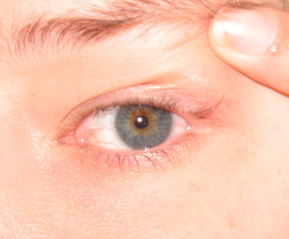 Life With Julie: Missing Eyelashes