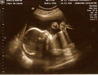 Jon and Kristin Virkler: 26 Week Ultrasound