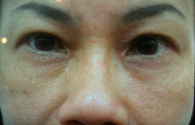 ageLOC - Time Will Never Tell