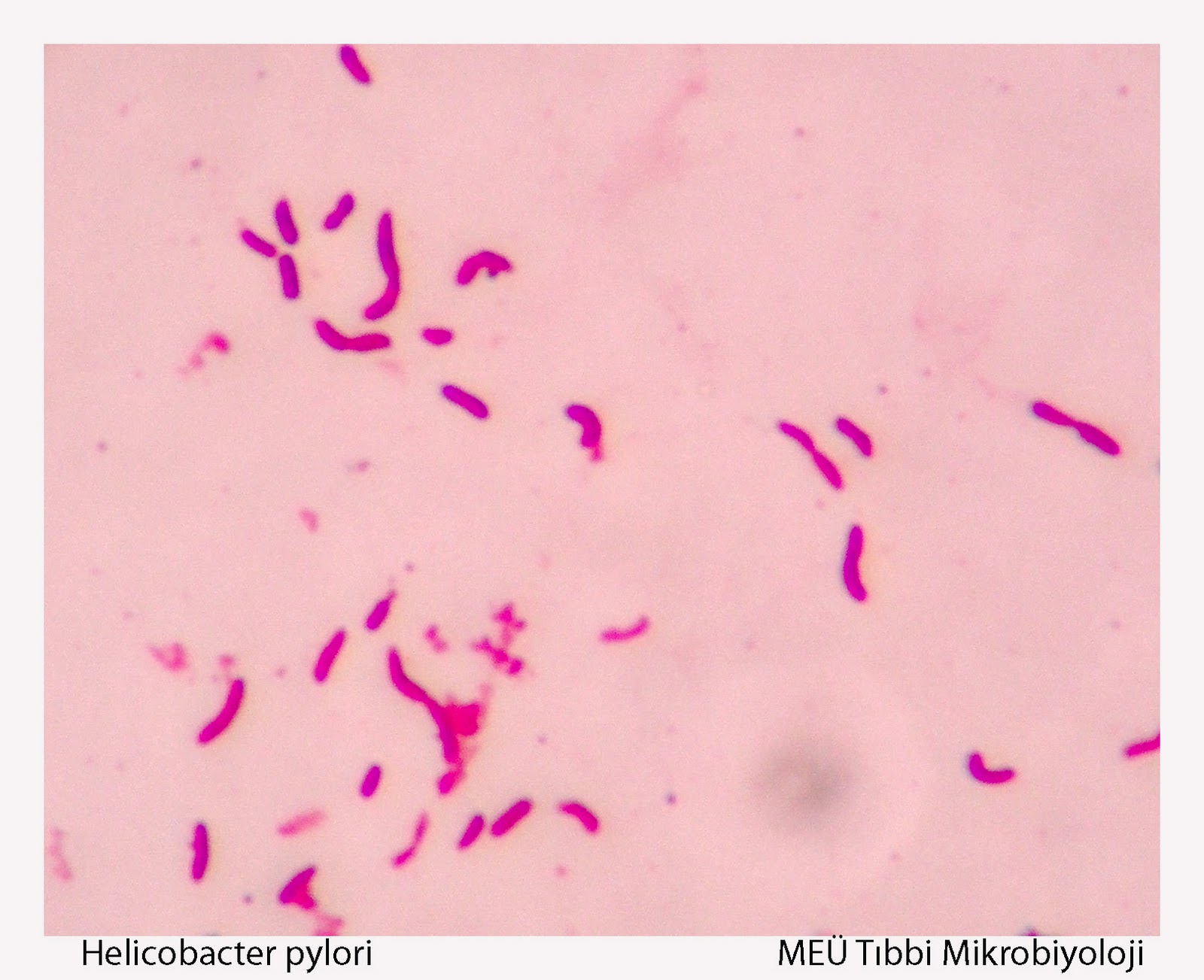 Fezabahçesi: Helicobacter pylori