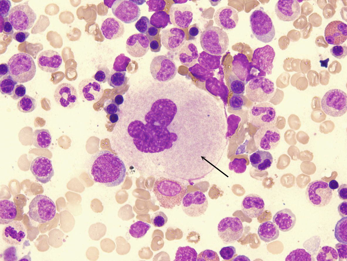 Atlas de Hematología: Células Trobopoyéticas