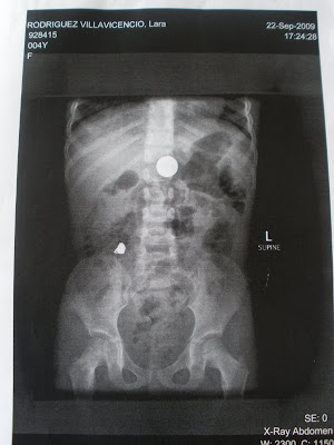 Lara Rodríguez Villavicencio: Moneda en el estomago