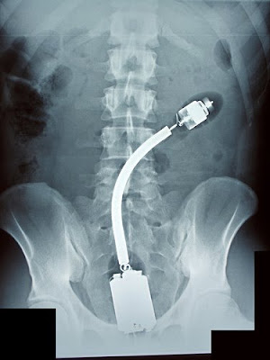 Buzz Lightyear X-Ray : r/WTF