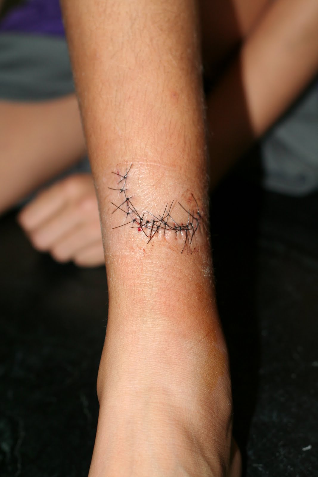 Denton Sanatorium: Red--The Blood of Her Flayed Leg; Black--The Thread ...