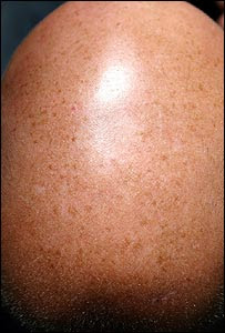 No te metas con los calvos...