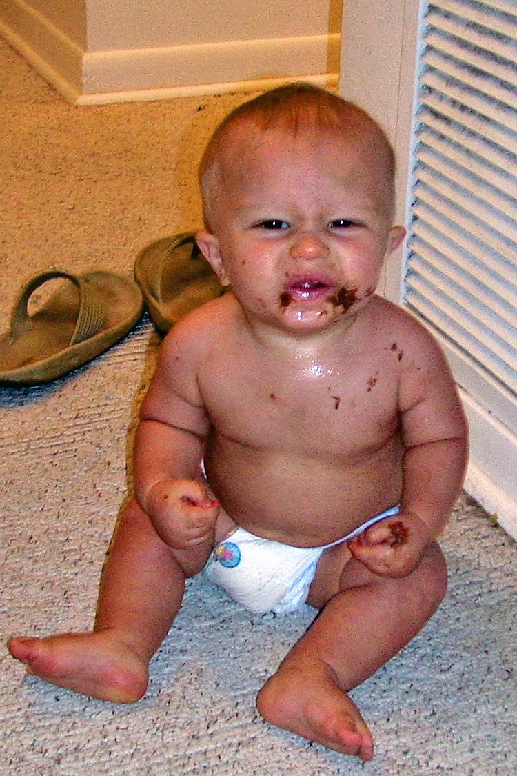 Hypochondroplasia Dwarfism