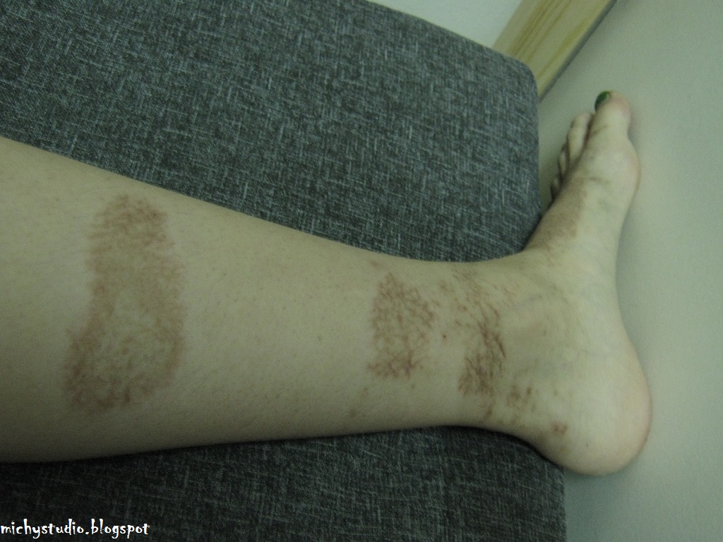 The Pondering Introvert©: Distorted Legs