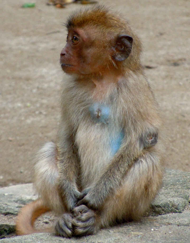 How Common Is Whooping Cough