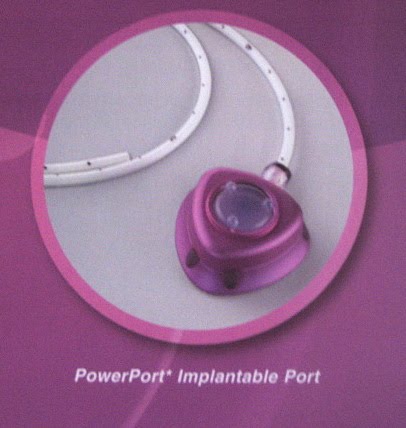 On The Road Again - well, not really: It begins