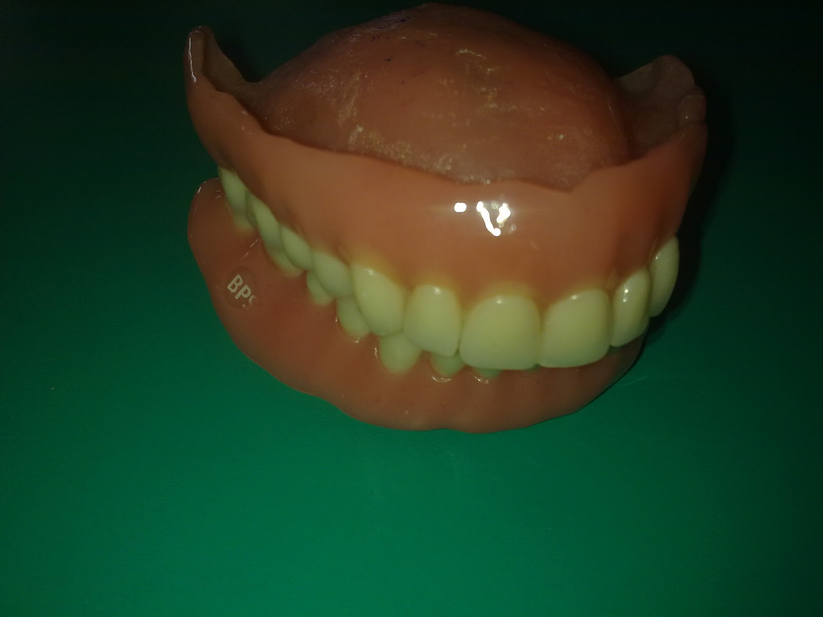 DENTO CARE DENTAL CLINICS: BIO PROSTHETIC SYSTEM-COMPLETE DENTURE