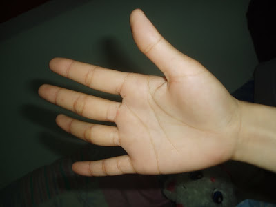 ♥¤.¸¸.·*☆*Bear Bear Diary*★*·.¸¸.¤♥: Extra horizontal line on my finger.