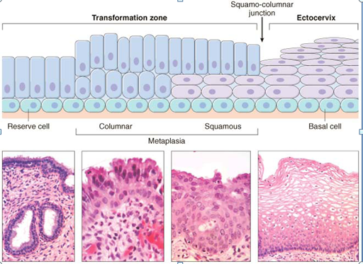 MBBS Medicine (Humanity First): Cervical transformation zone.