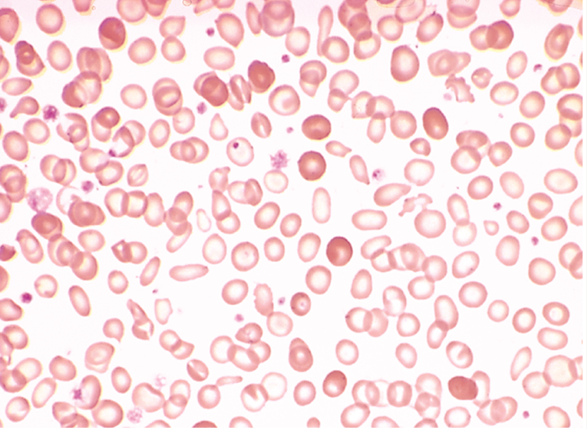 CLINICAL PATHOPHYSIOLOGY OF THE BLOOD SYSTEM – MedMuv