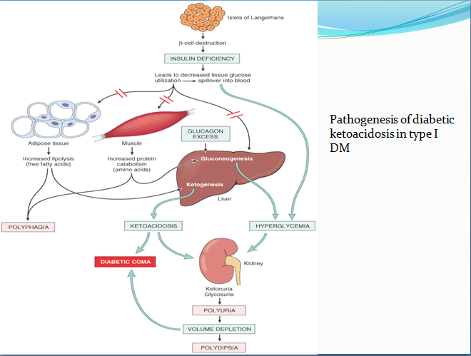 MBBS Medicine (Humanity First): Pathogenesis of type I DM.