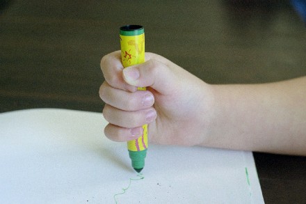 Agenesis Corpus Callosum: Handwriting Help