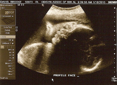 The Story of Us: Ultrasound Pics - 29 weeks, 4 days