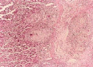 Disease Encyclopedia - List of Diseases and Medical Resource