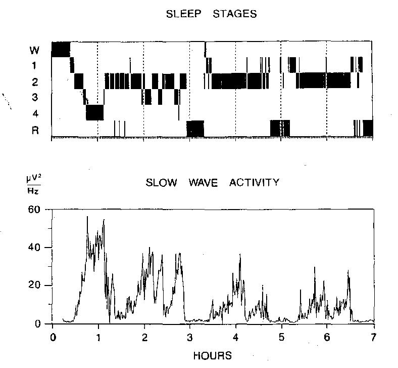 Cognitive Convolutions: Big ideas in sleep: Borbély's Two Process Model