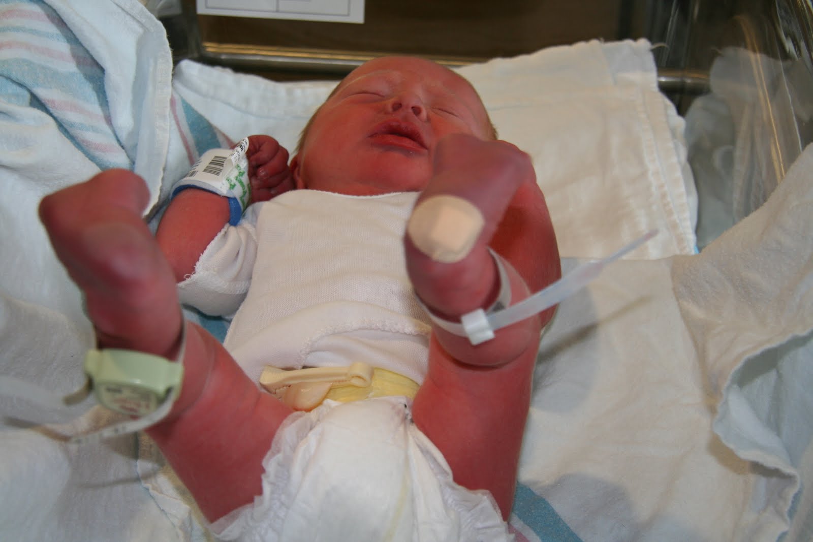 The Burrus Family: Breech Legs