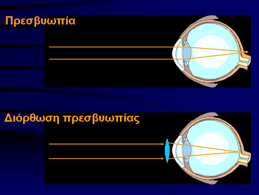 Α΄τάξη σε δράση: Τι χρώμα έχει το σκοτάδι;
