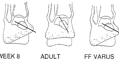 Thoughts of an Experienced Sports Physical Therapist: What is a ...