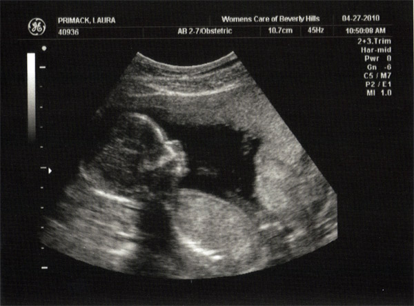 Our Little Munchkin: 16 week Ultrasound