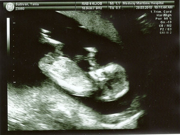 Pregnancy Round-Up - Week 14 | Larger Family Life