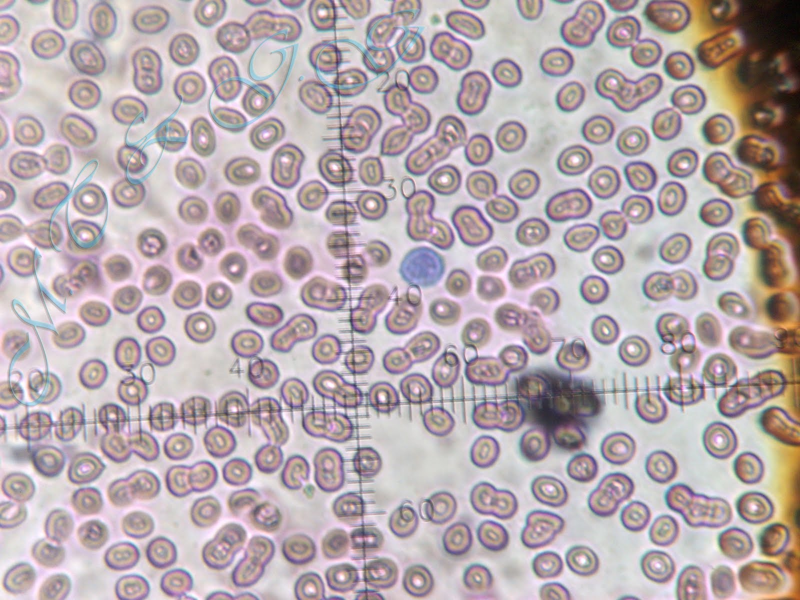 ANADOLU BİYOLOJİ: Histoloji Lab. Fotoğrafları / Destek Doku / Kan ...