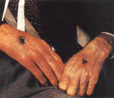 I'm Curious Too: Stigmata