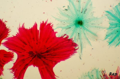 Macro y microfotografia: Microfotografía: Escamas de cabello