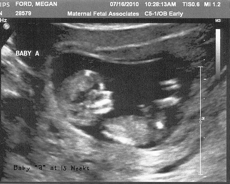 .: Babies at 13 Weeks