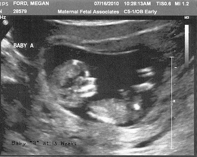 .: Babies at 13 Weeks