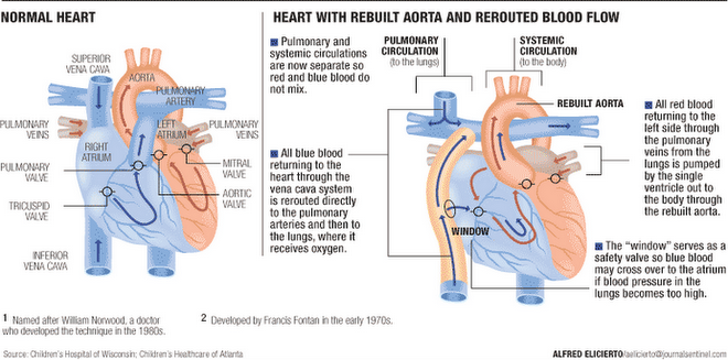 Team Travis: Norwood Operation Photos