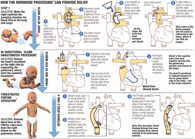 Team Travis: Norwood Operation Photos