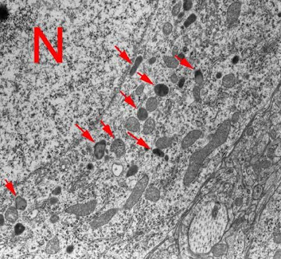 Tecnología Médica Mención Morfofisiopatología y Citodiagnóstico ...