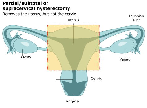 Healthy Life: Waspadai Kanker leher rahim (Ca cervix)