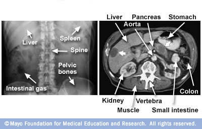 Healthy Life: CT scan