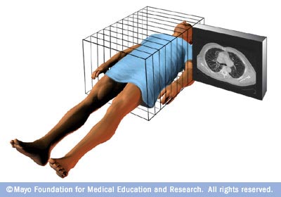 Healthy Life: CT scan