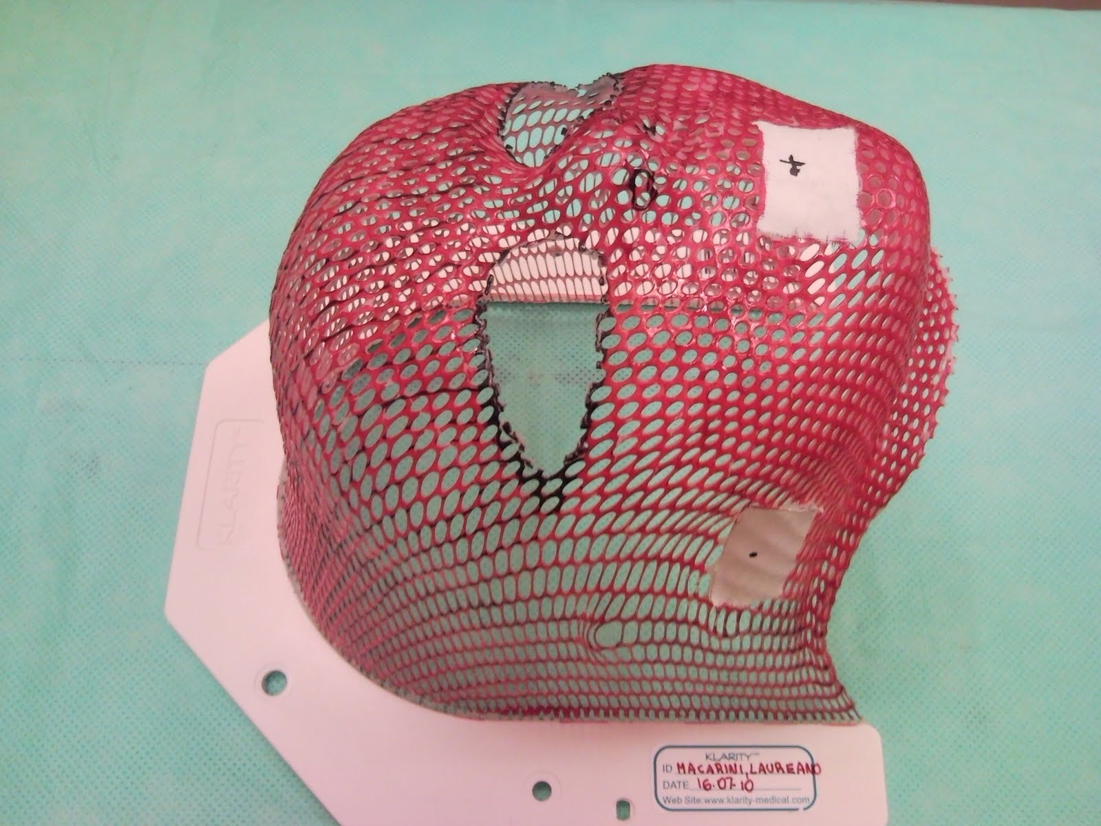 Atención Pediátrica en Radioterapia: Fotos de máscaras termoplásticas