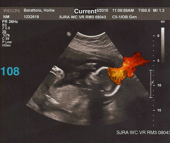 Solving for G: Holy Altered DNA, Batman! or ULTRAsounds!
