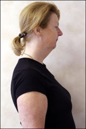 Like Seriously Poetic: Ode to the Chinless