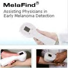 Beautytiptoday.com: Ground-Breaking MelaFind Melanoma Device Could Get ...