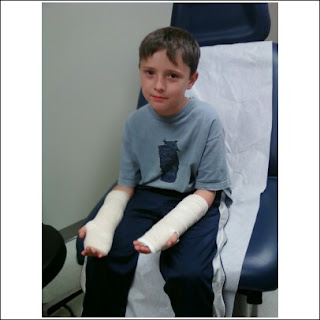 Brownrigg Family: 1 little boy + 1 trampoline = 2 broken arms
