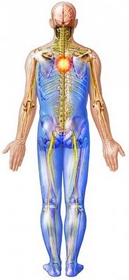 ARTÍCULOS INFANTILES: PARAPLEJÍA Y CUADRIPLEJÍA