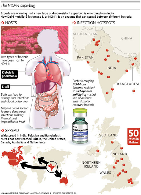 ॐ SUPERBUG - New Delhi metallo-beta-lactamase | Bizit