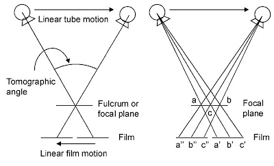 Radiography: Linear Tomography