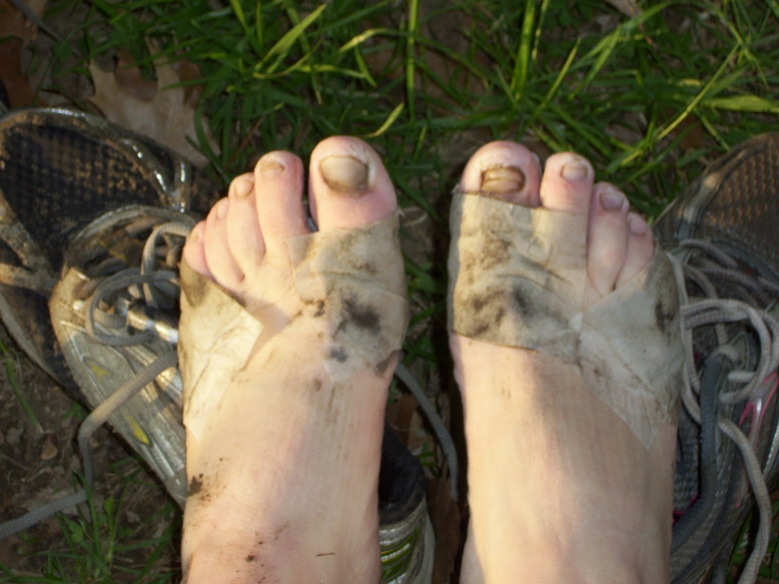 Foot Fungus Vietnam War at Esperanza Bruns blog