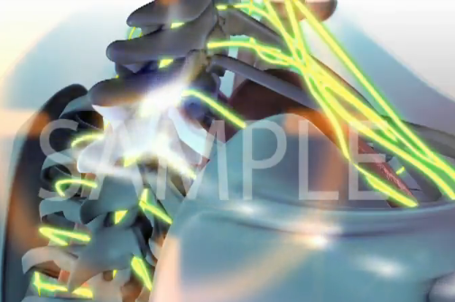 Atlas Chiropractic System: Atlas Chiropractic System Launches the ...