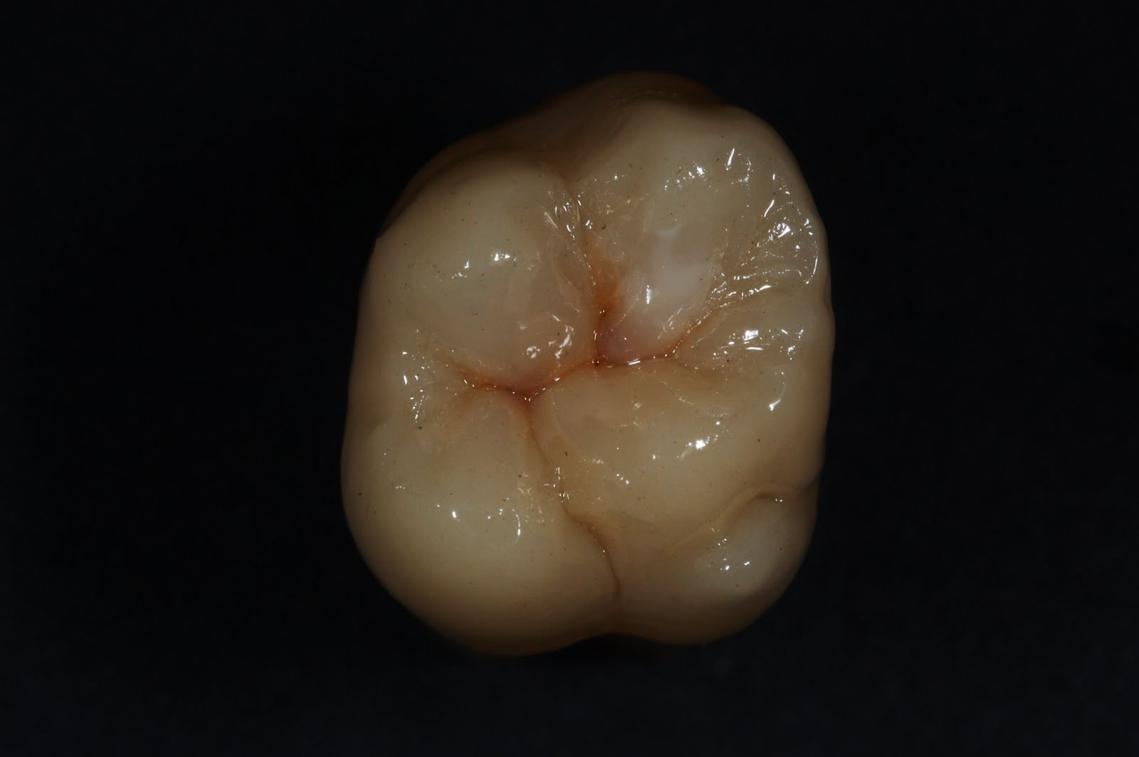 Anatomia Cabeça e Pescoço-ACPUPE: Generalidade sobre Dentes