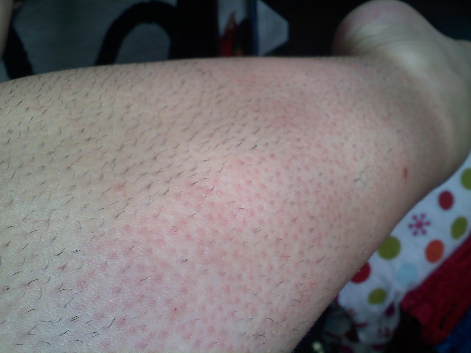 Lindsey & Anthony: Esthetician:1 Lindsey :0